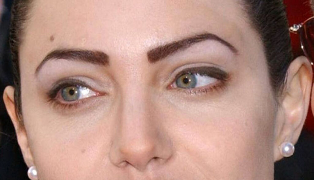DO EYEBROWS GROW BACK? - otranation